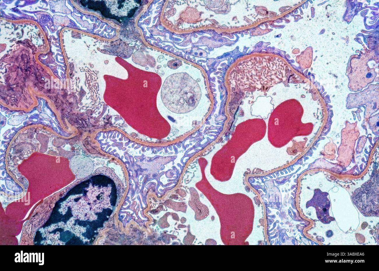Glomerulus. Coloured transmission electron micrograph (TEM) of a ...