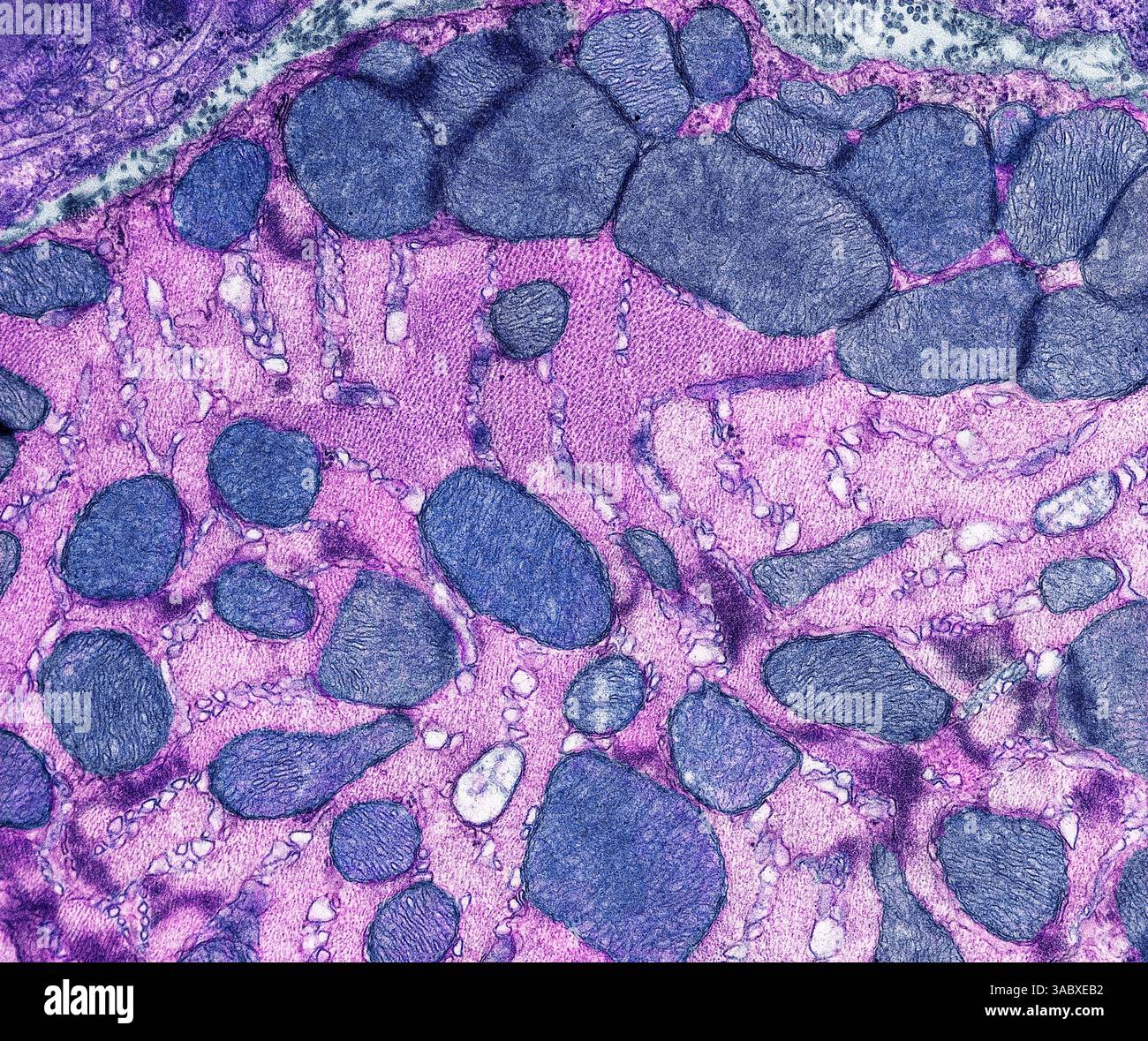 Smooth muscle, TEM Stock Photo - Alamy