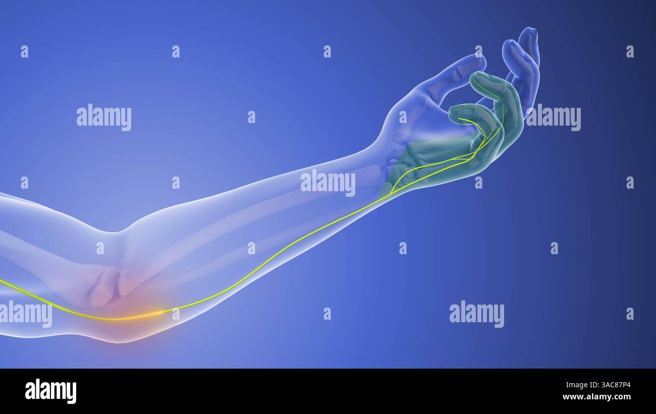 Nerve Compression Issues in Cubital Tunnel Syndrome Stock Photo - Alamy