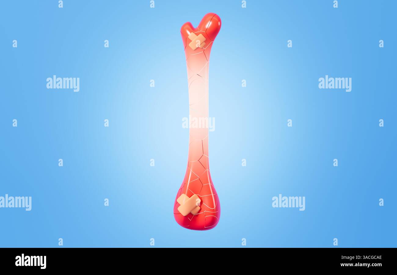 Human kneecap model, arthrophlogosis, joint swelling, joint pain ...