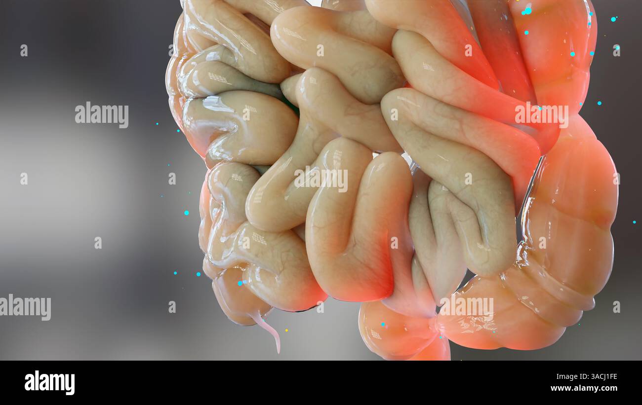 irritable bowel syndrome (IBS) Treatment, Medications for Functional ...