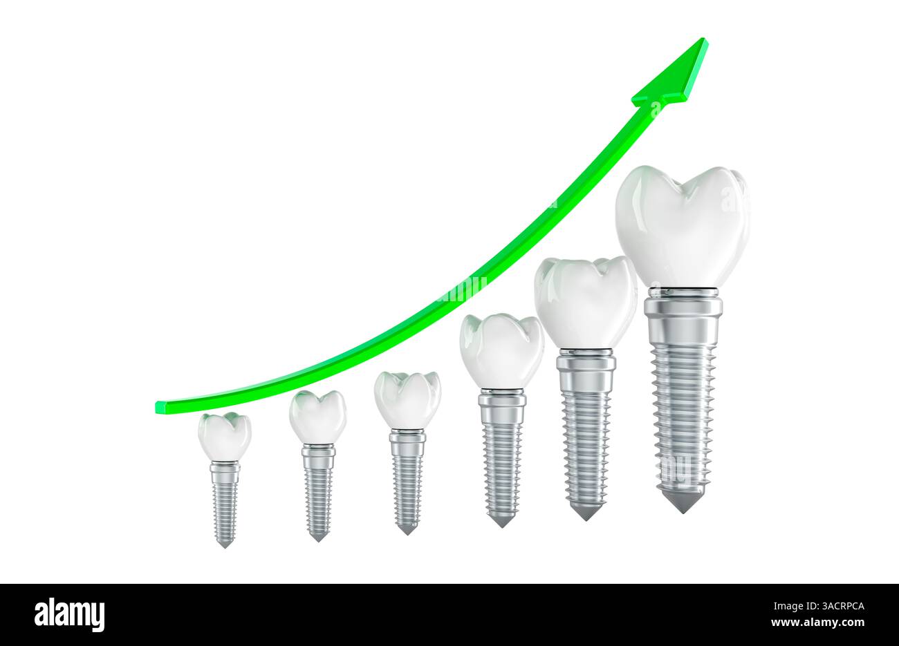 Growing chart from Dental Implant. 3D rendering isolated on white ...