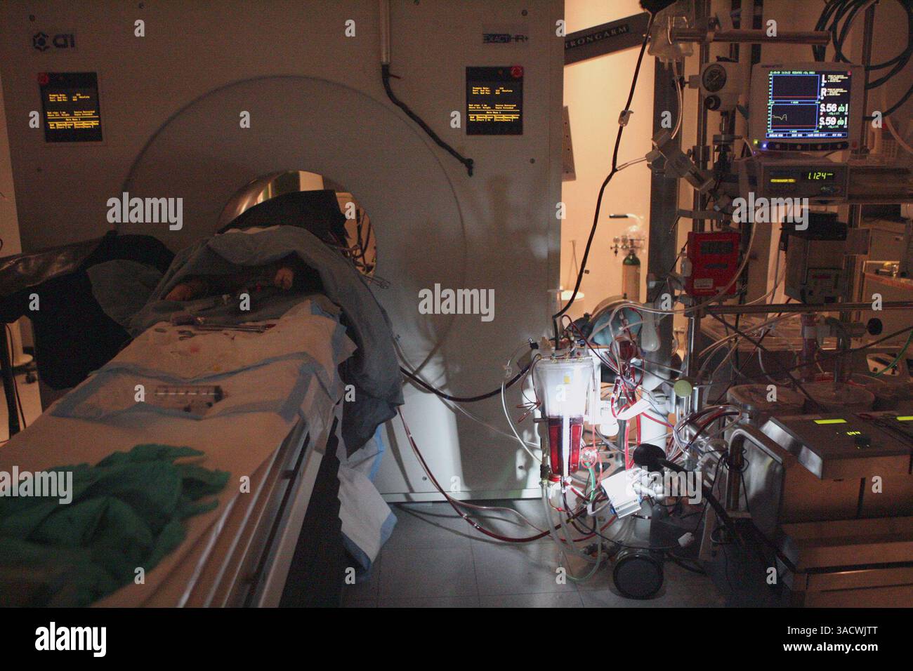METRO An anesthetized 50-pound pig lays inside a PET scanner,or ...