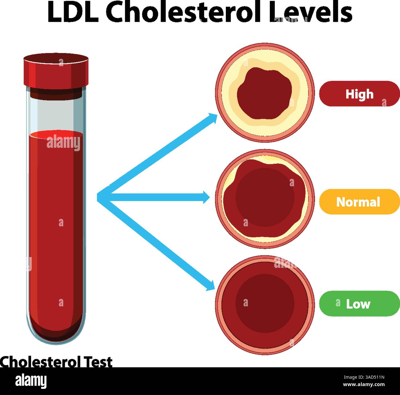 Illustration of LDL cholesterol levels in blood Stock Vector Image & Art - Alamy