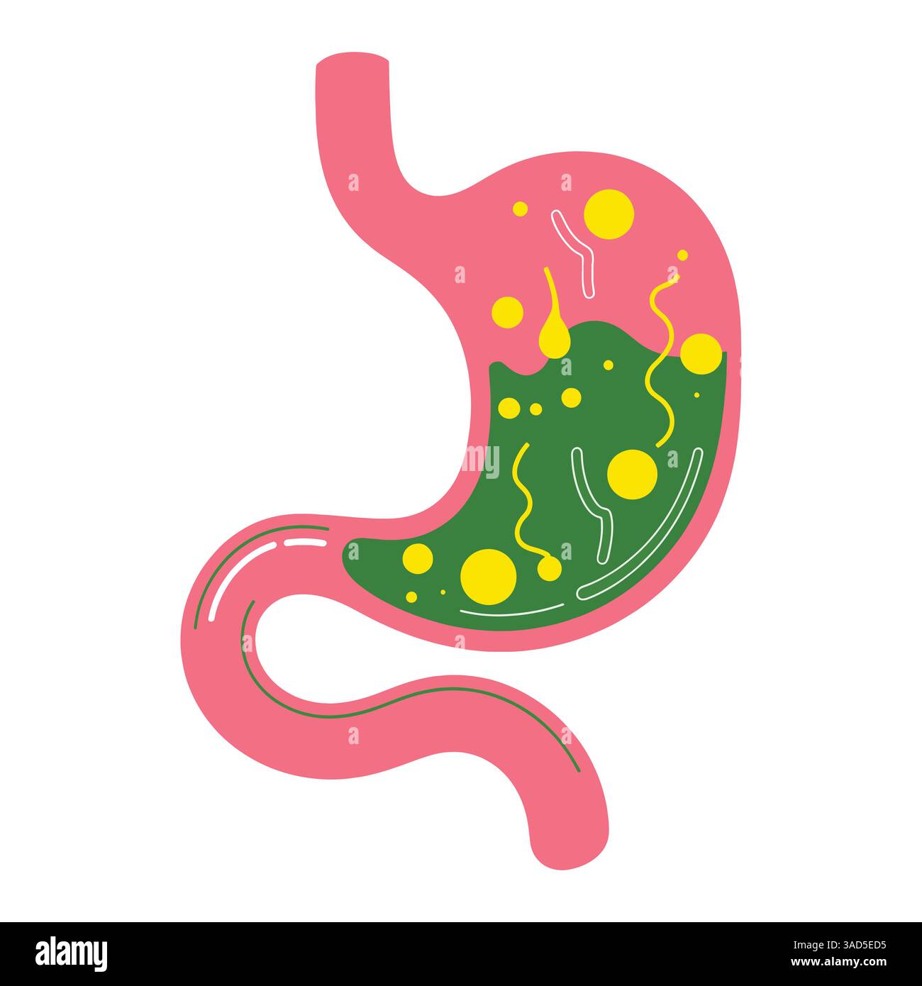 Human stomach vector illustration. Depicts gastritis, acid reflux ...