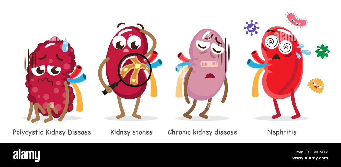Kidney diseases . Include Polycystic Kidney Disease, Renal stones ...