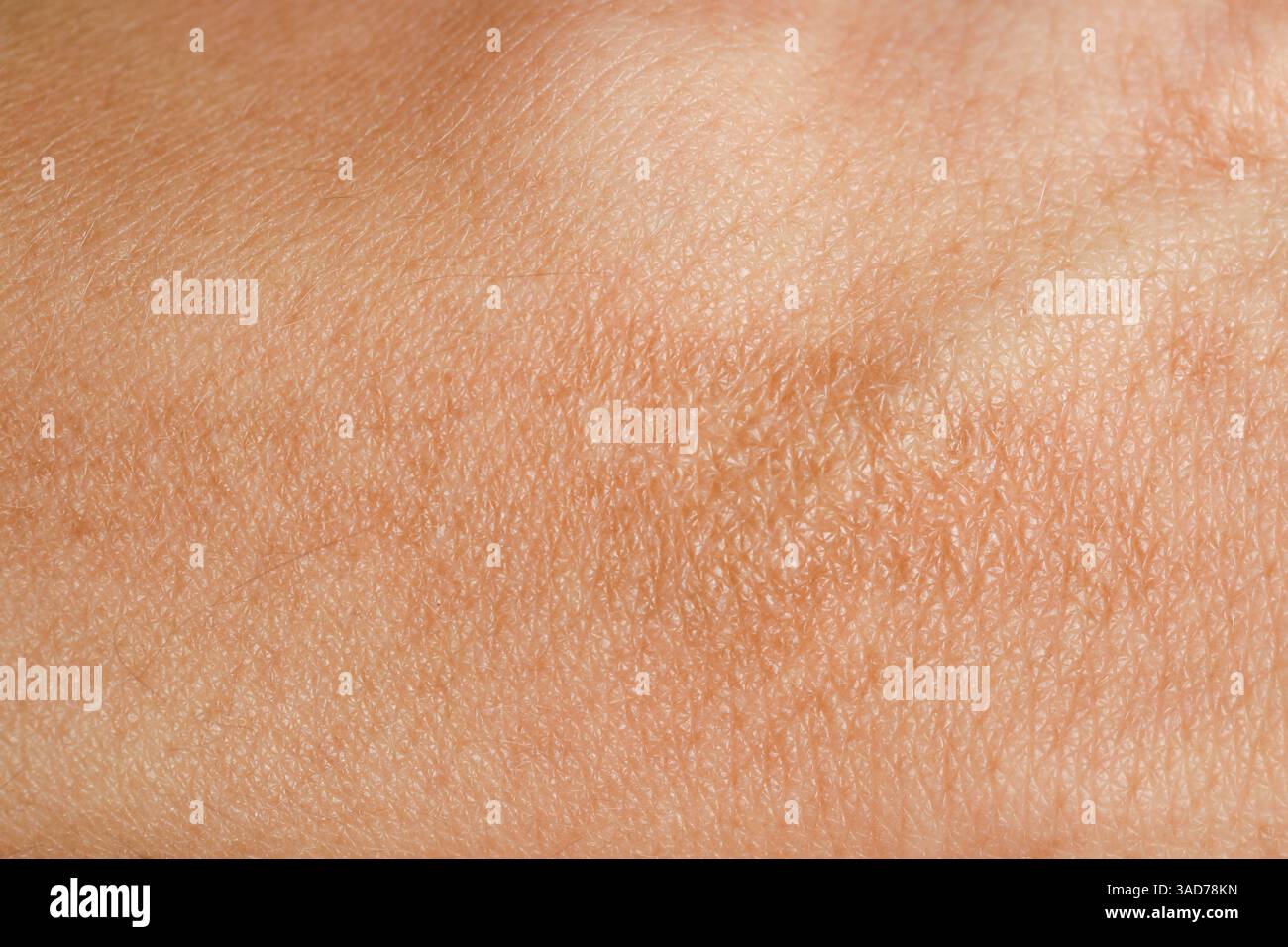 Texture of skin with scar as background, closeup Stock Photo - Alamy