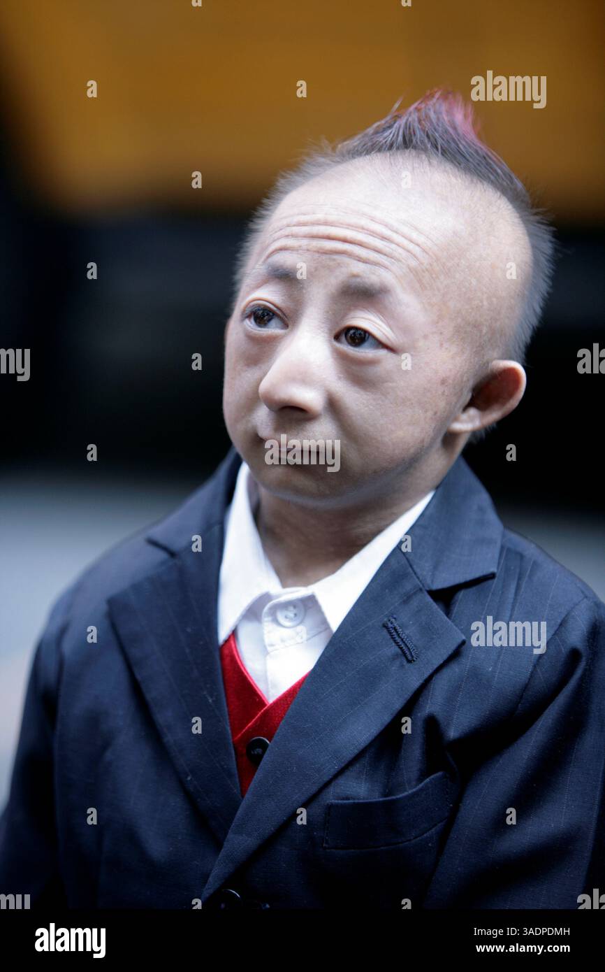 New York - USA - September 18 2008 - Pingping, born with primordial dwarfism, holds the Guinness ...