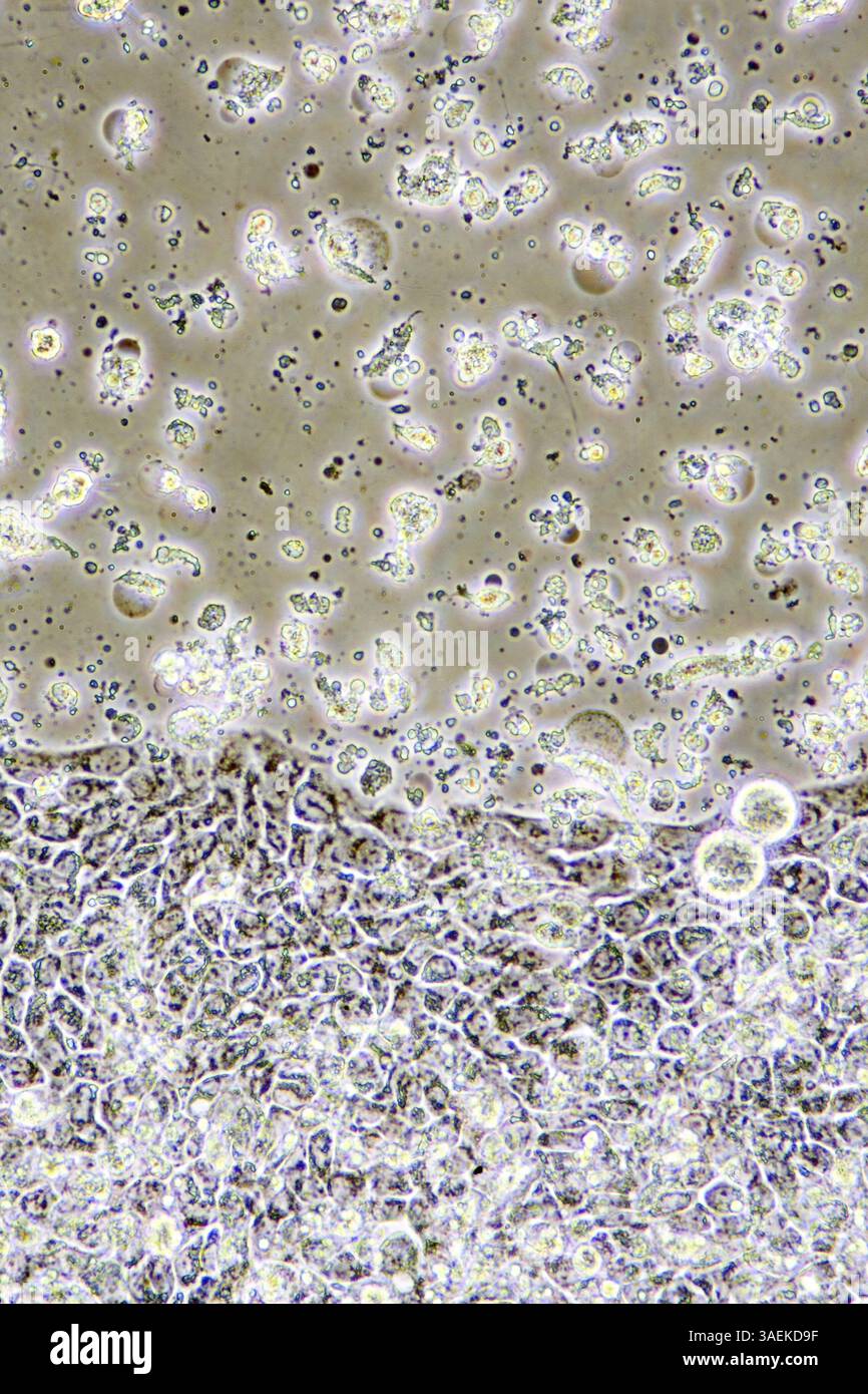Microscope view of Colon Cancer cells in tissue culture showing walls ...