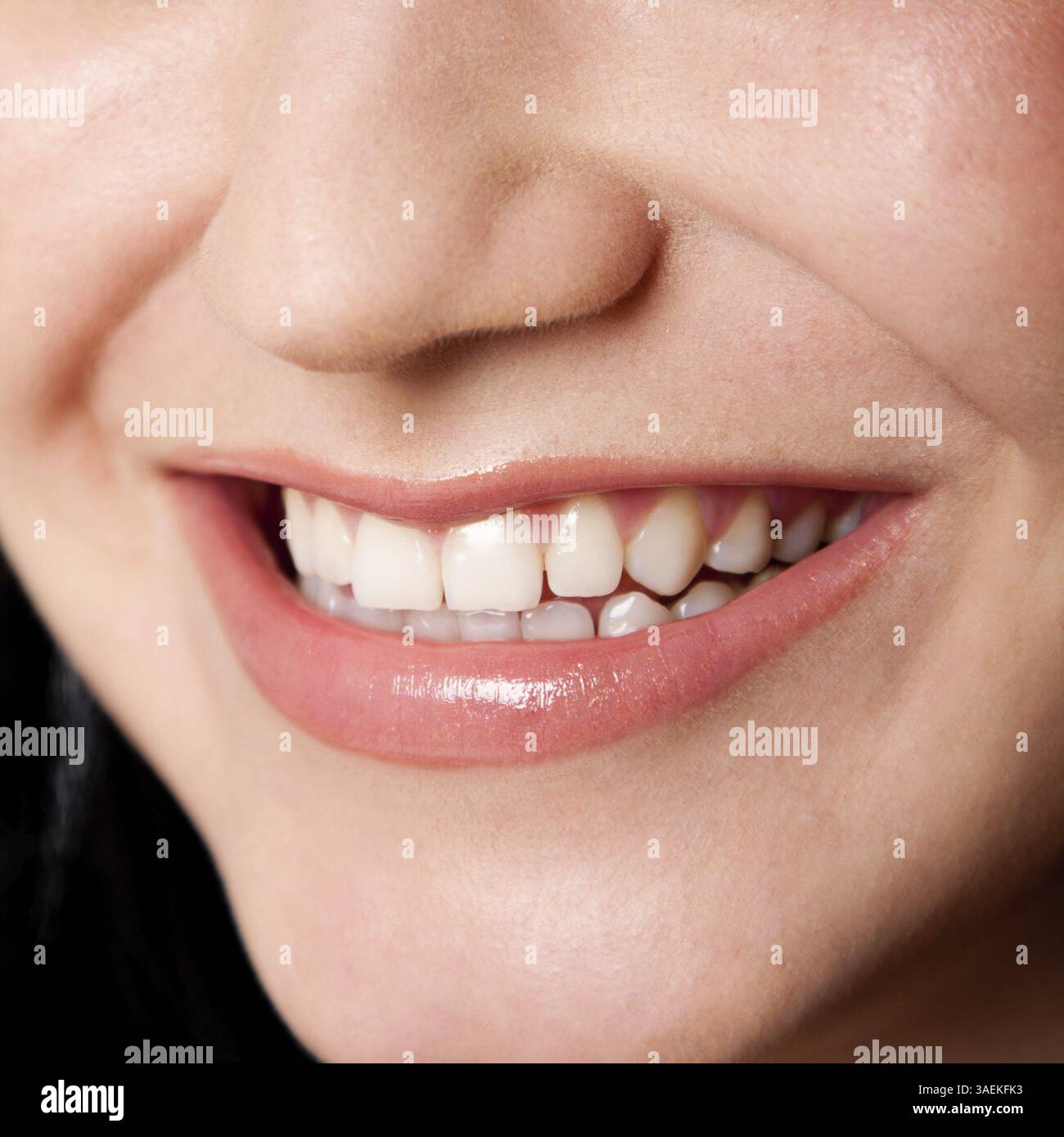 Beautiful white teeth in a perfect happy smile of a female face ...