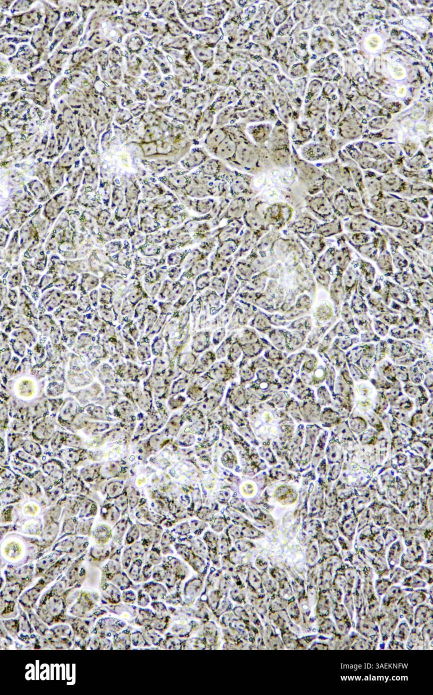 Microscope view of Colon Cancer cells in tissue culture showing walls ...