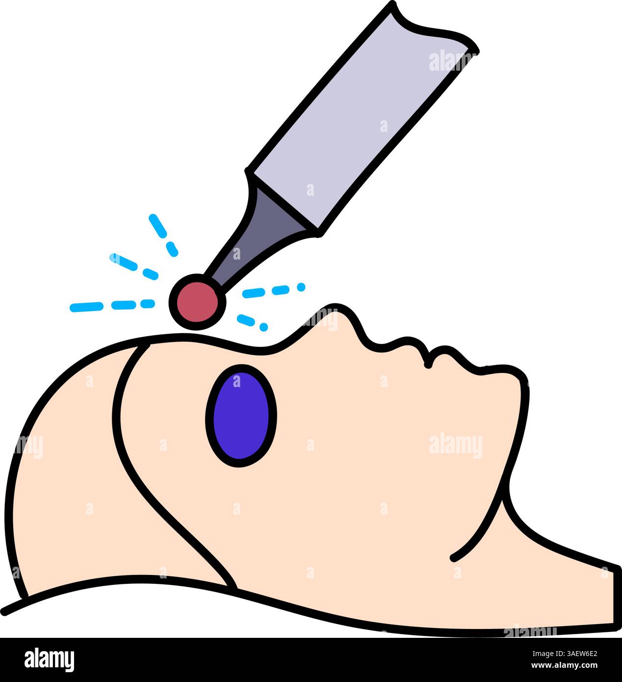 beauty skin laser treatment hand drawn color vector illustration Stock ...