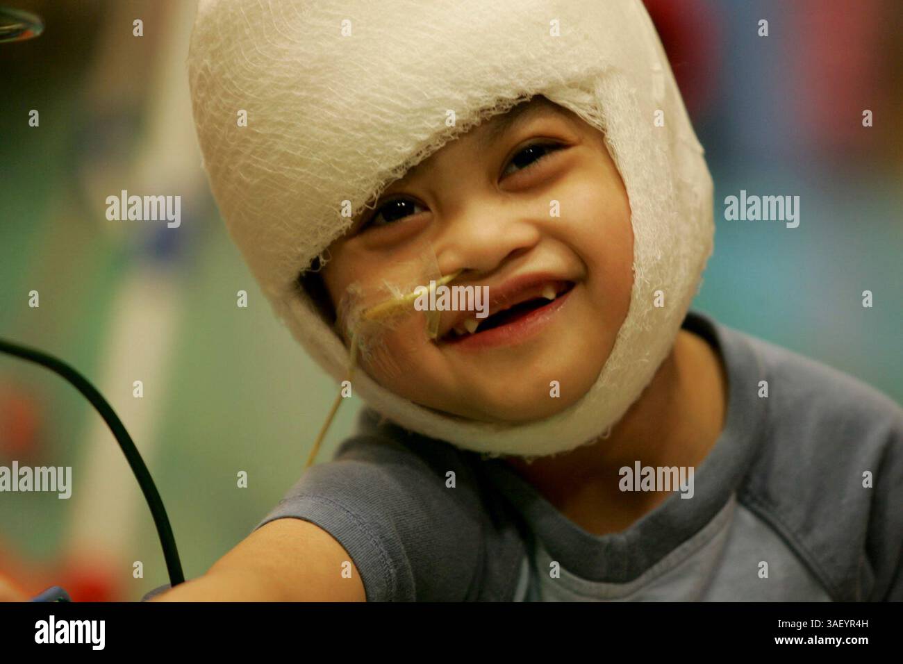 Dec 15, 2004; Bronx, NY, USA; Formerly conjoined Filipino twins Carl ...