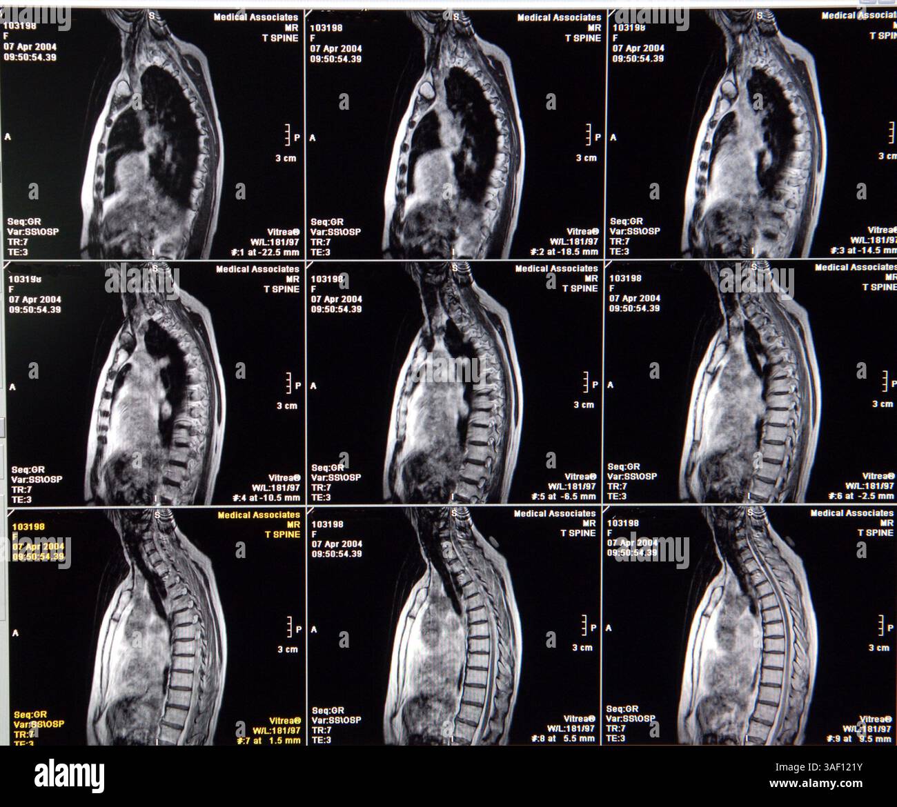 May 05, 2005; USA; (File photo exact date and location unknown) CT scan ...