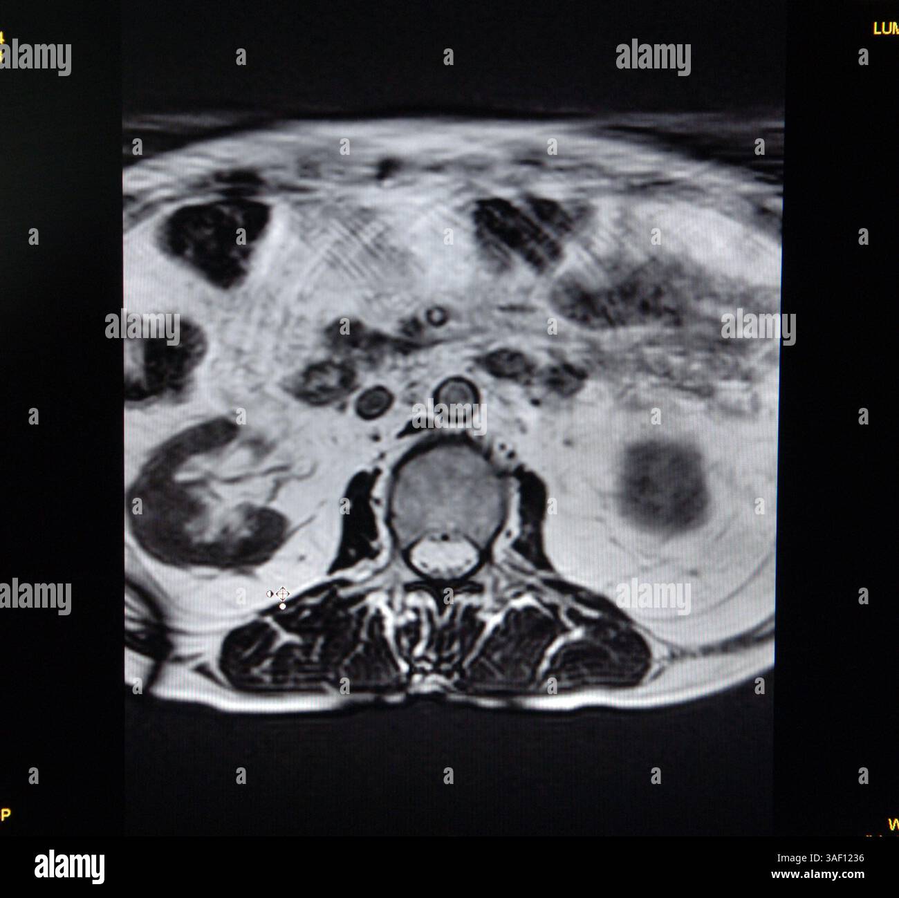 May 05, 2005; USA; (File photo exact date and location unknown) CT scan ...