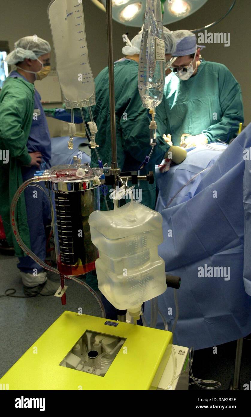 Fresenius continuous autotransfusion system hi-res stock photography ...