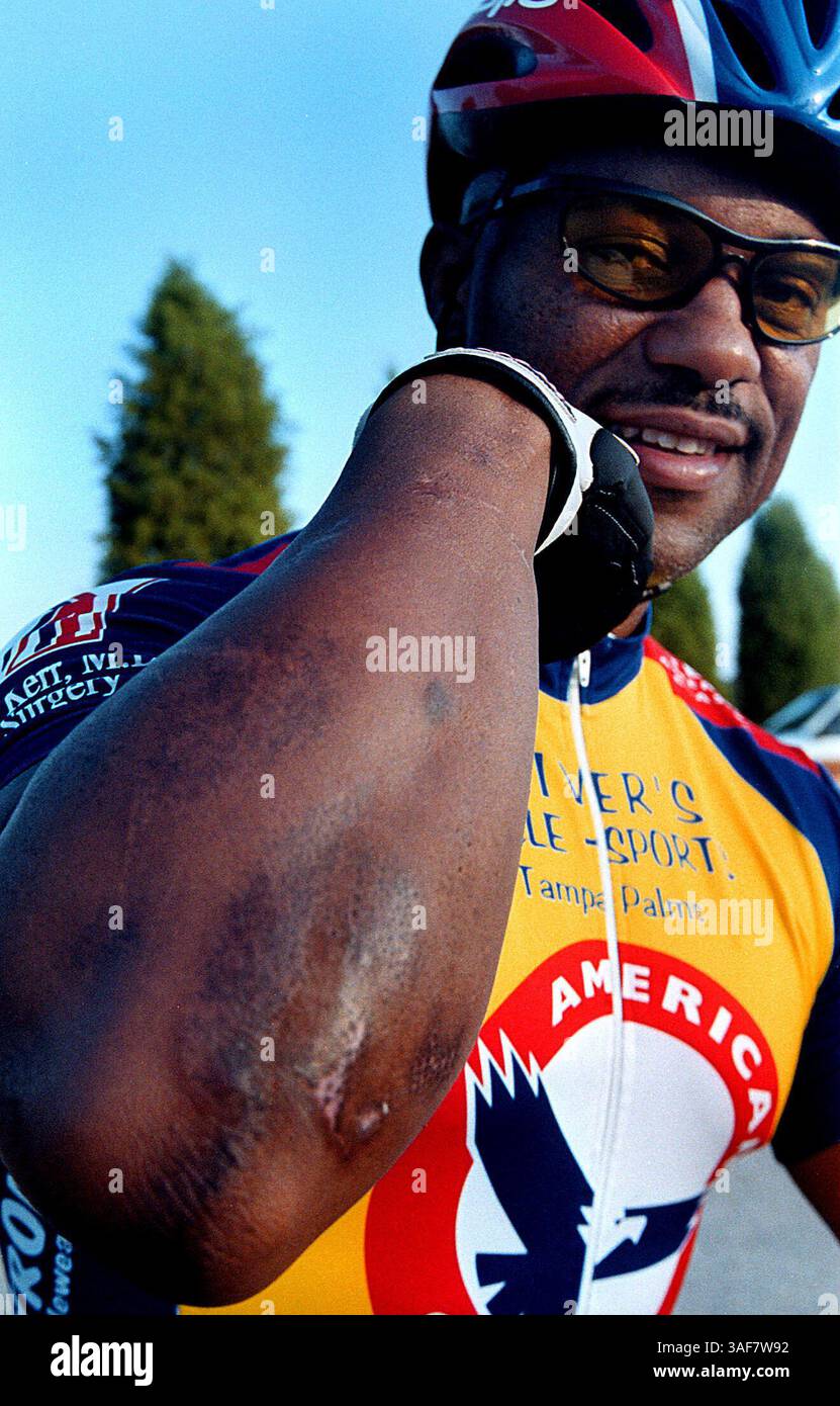 Scars arm hi-res stock photography and images - Alamy