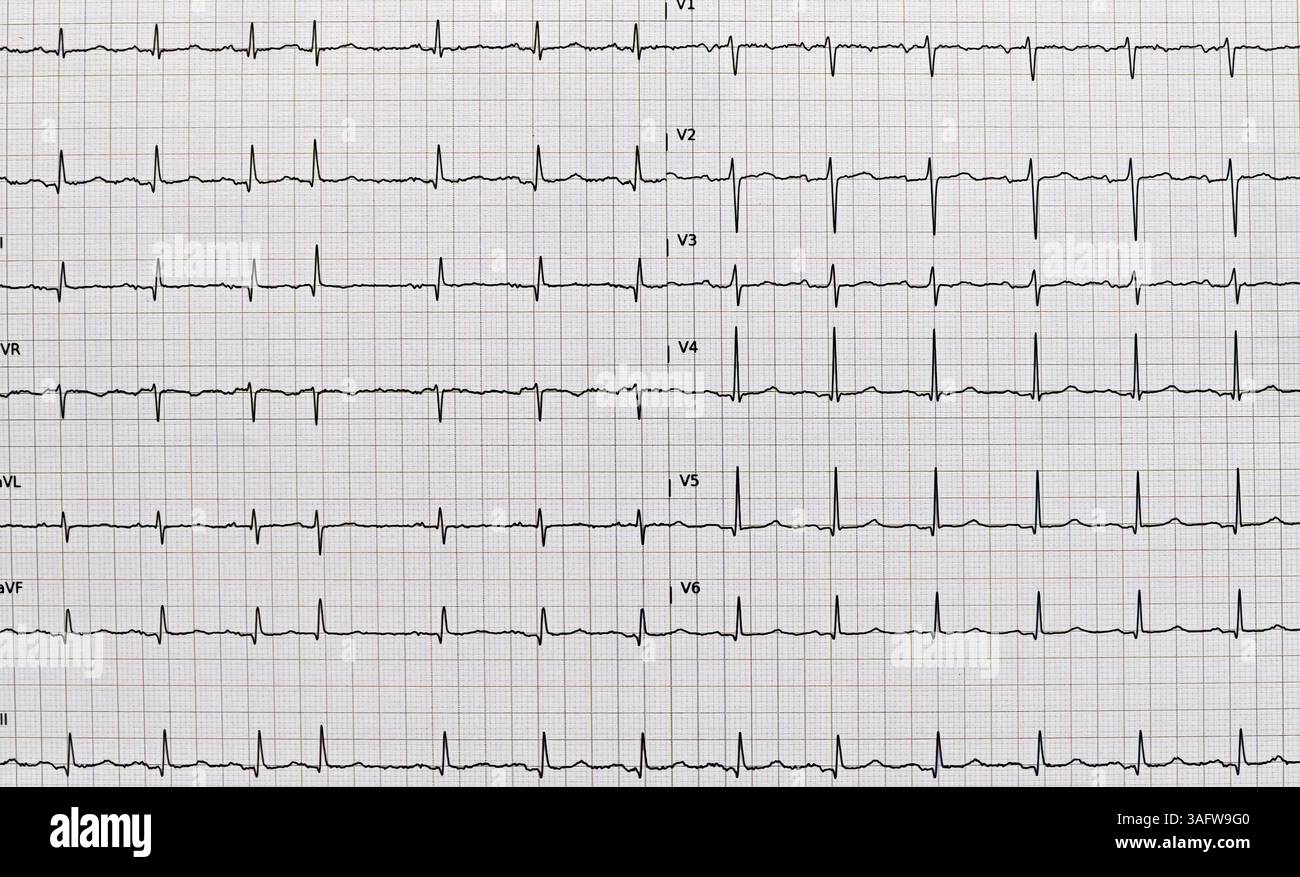 Heartbeat patterns hi-res stock photography and images - Alamy