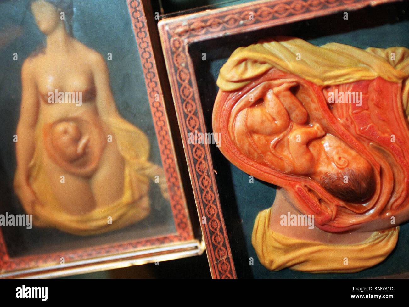 Part of the human cadaver exhibit on display at the National Museum of ...