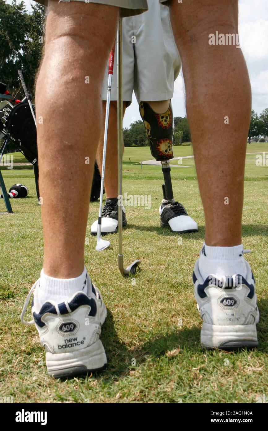 CAPTION: (Trinity 08/22/2007) Donny Alston (cq) , 44, an amputee who ...