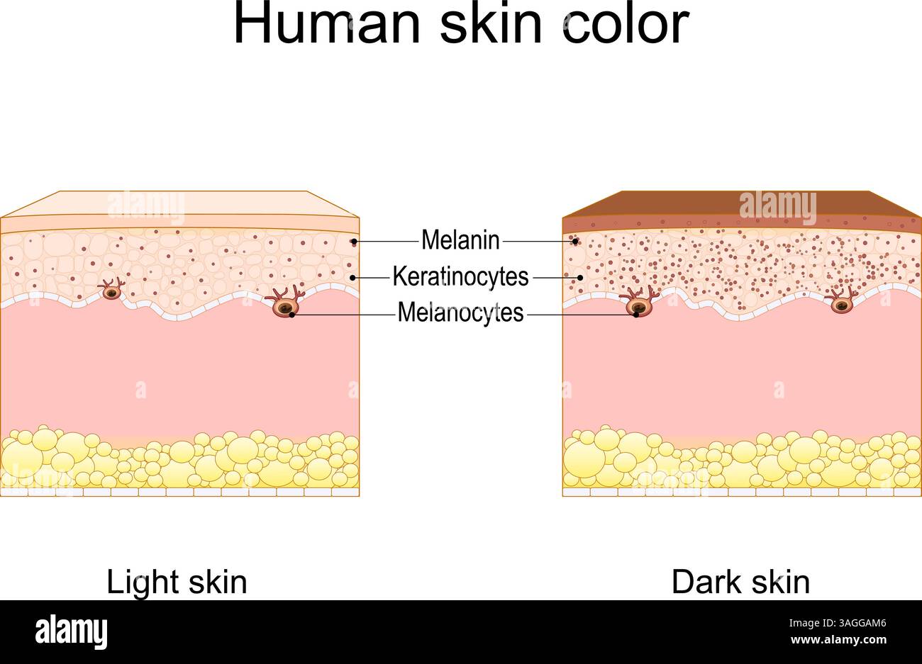 Melanin and skin color. Cross section of a human skin. Close-up of ...