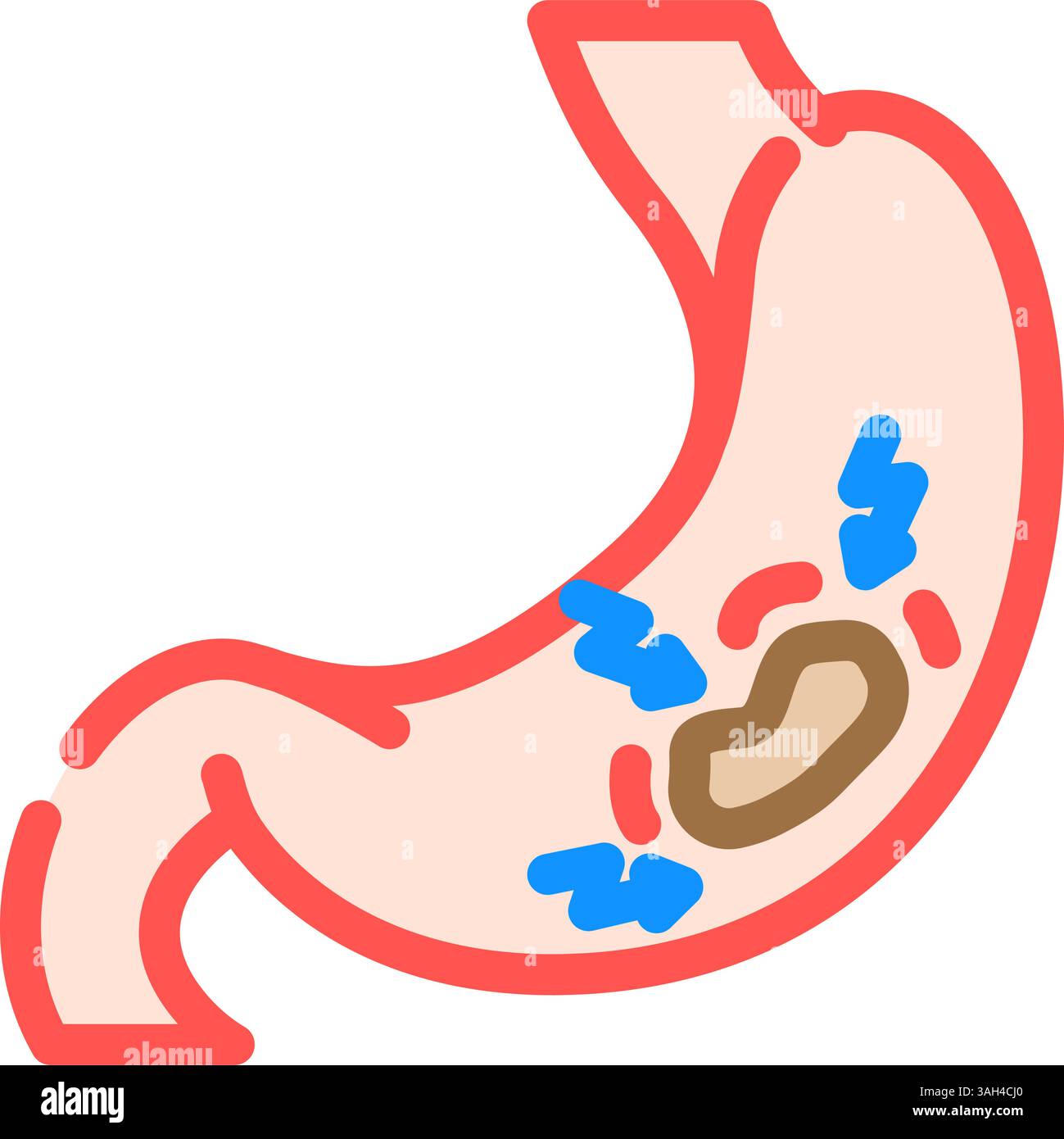 gastric ulcer gastroenterologist color icon vector illustration Stock ...