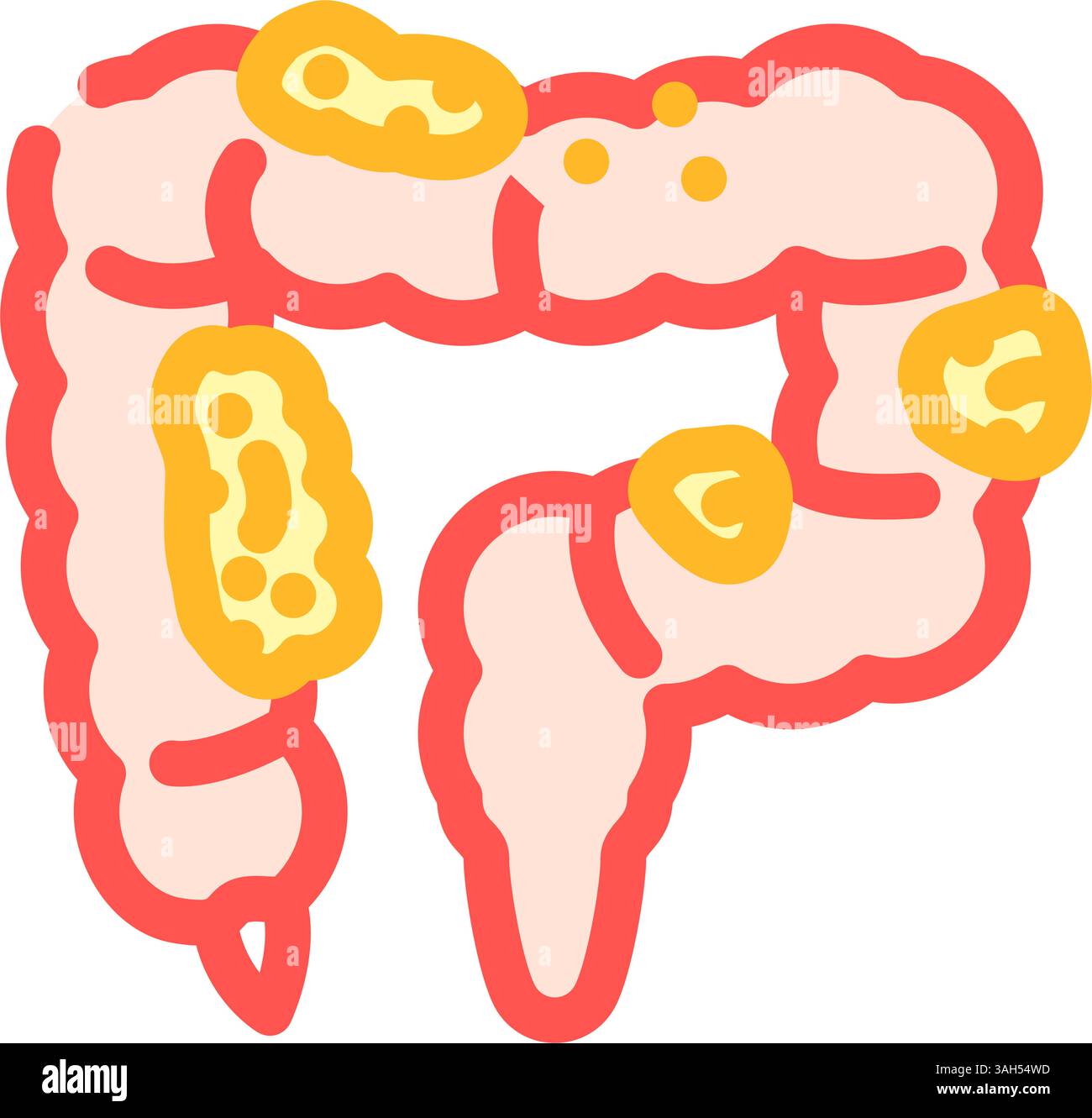 crohn disease gastroenterologist color icon vector illustration Stock ...