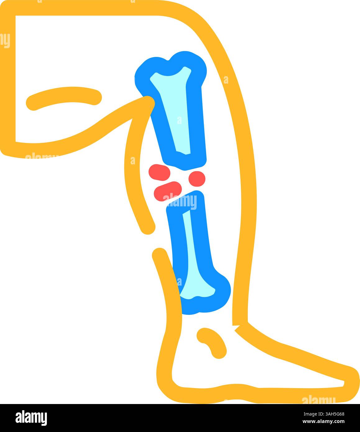 broken leg fracture injury color icon vector illustration Stock Vector ...