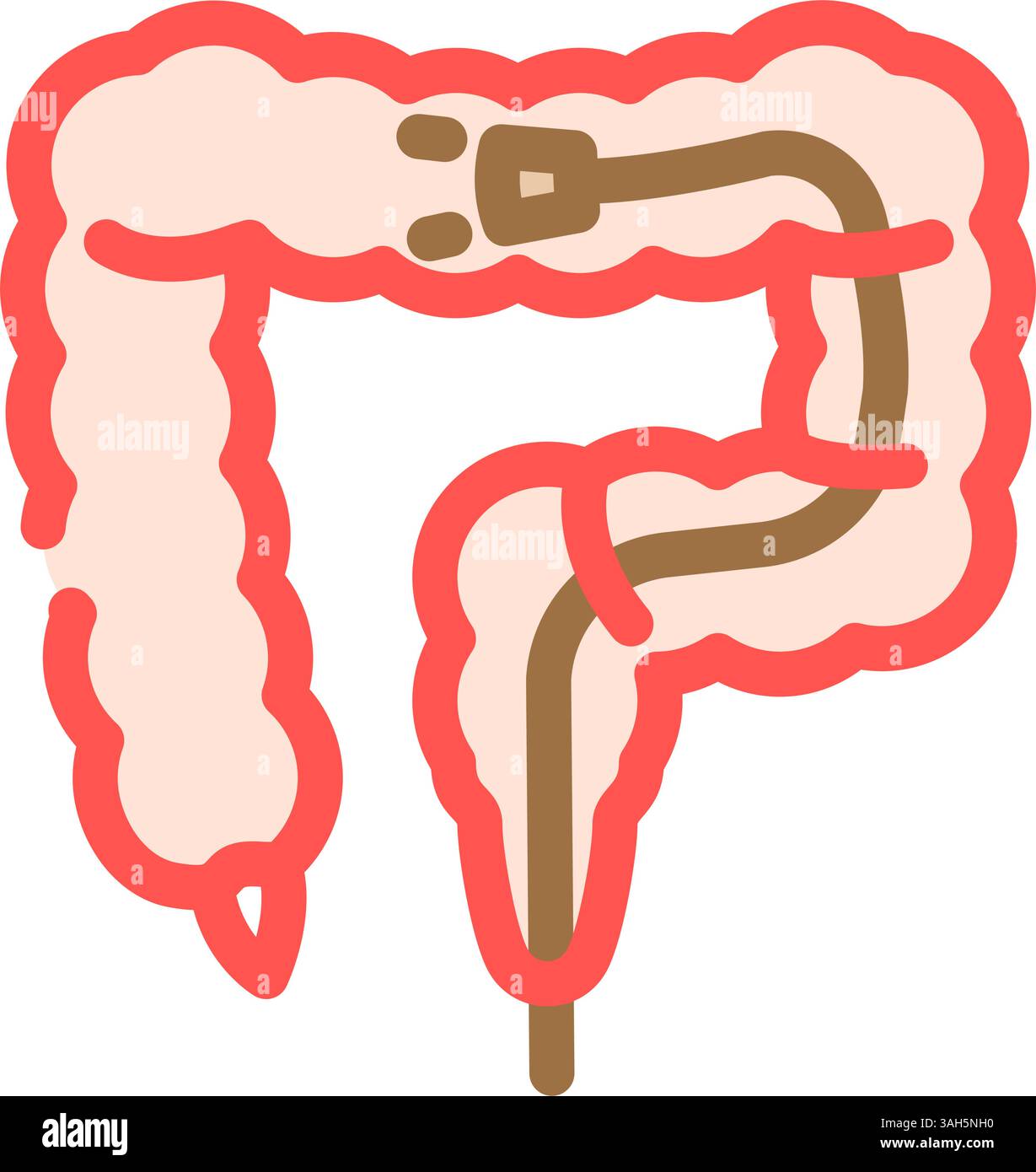 colonoscopy examination color icon vector illustration Stock Vector ...