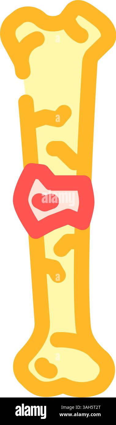 bone healing fracture injury color icon vector illustration Stock ...