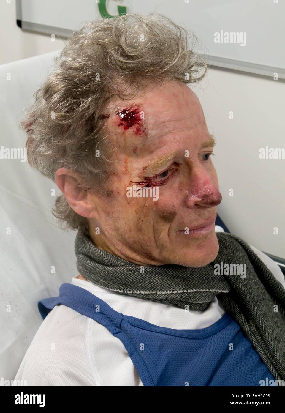 Trauma injured patient bicycle hi-res stock photography and images - Alamy