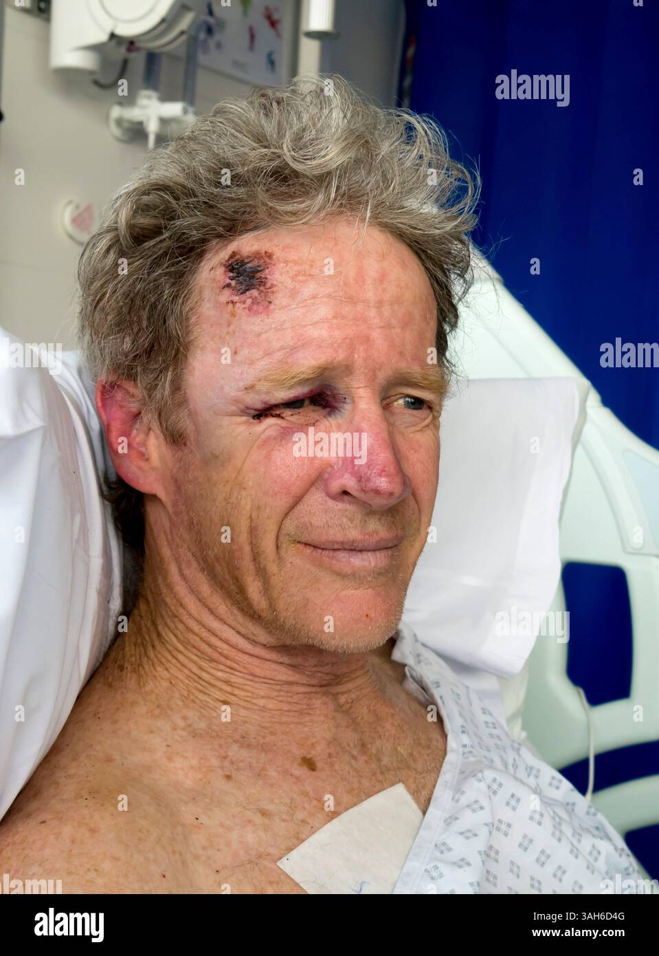 Trauma injured patient bicycle accident bed Stock Photo - Alamy