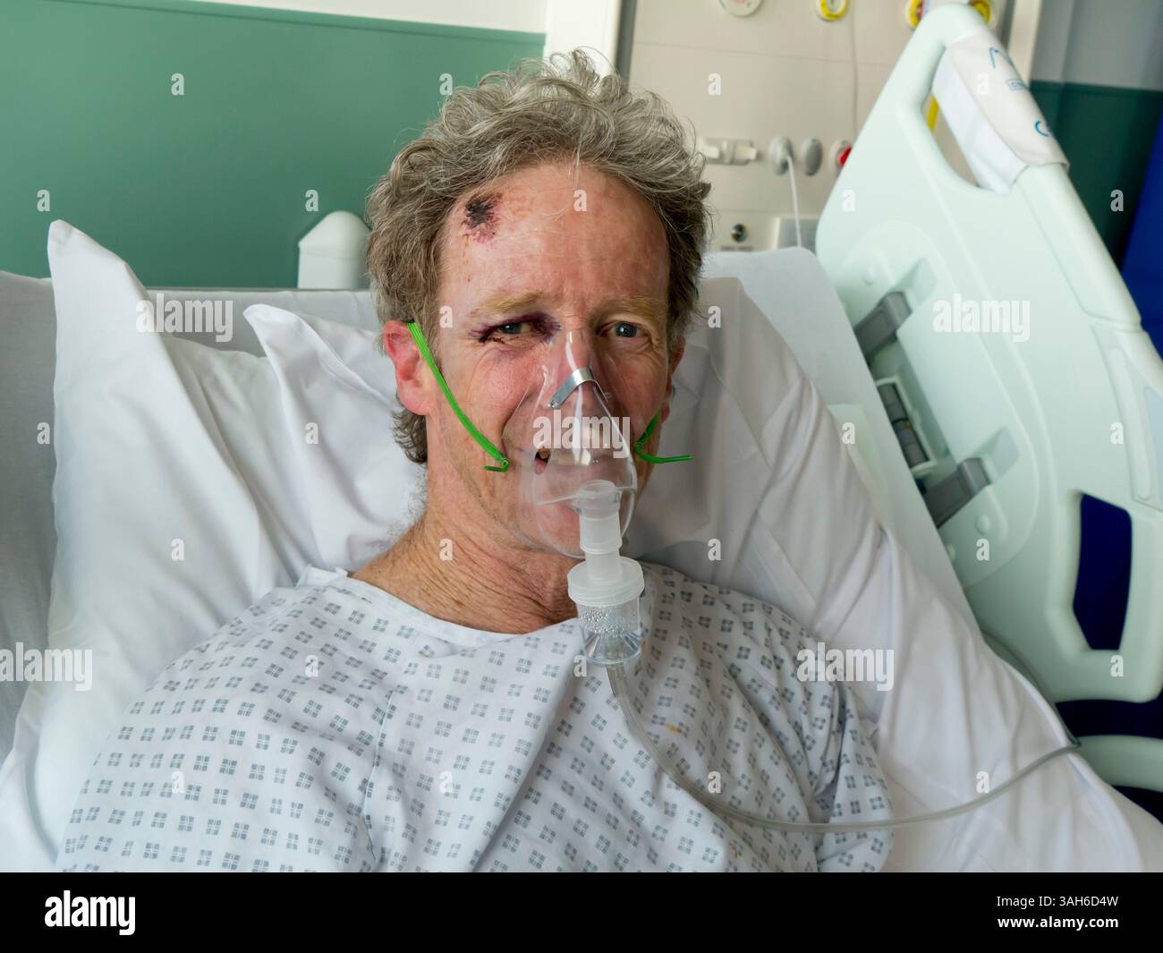 Trauma injured patient bicycle accident nebuliser Stock Photo - Alamy
