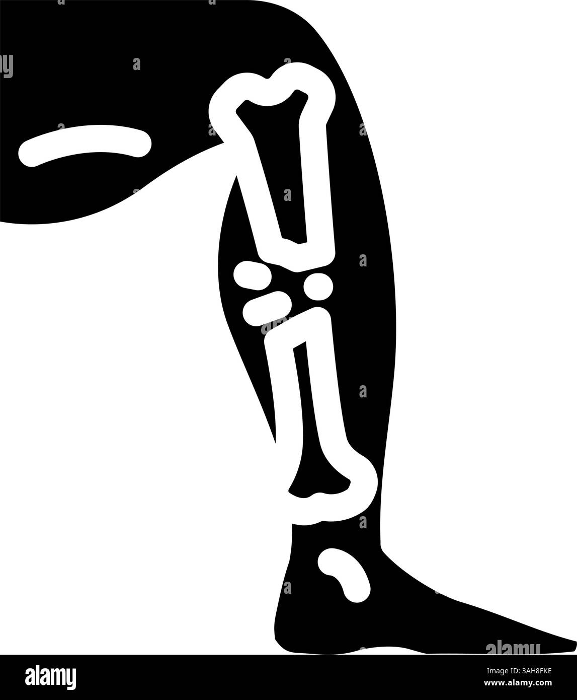 broken leg fracture injury glyph icon vector illustration Stock Vector ...