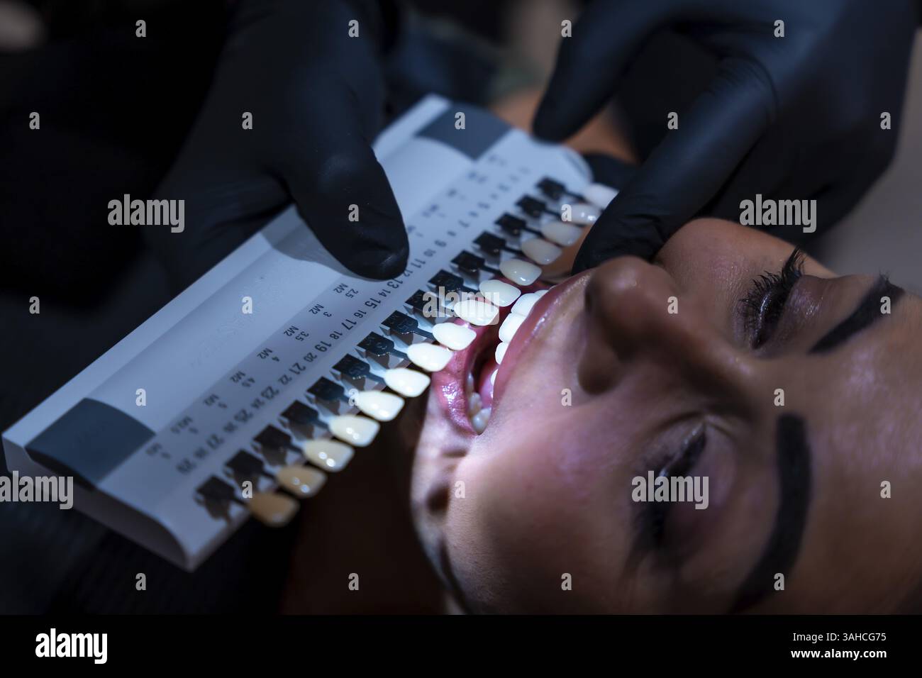 Dentist comparing patient's teeth shade with tooth whitening shade ...