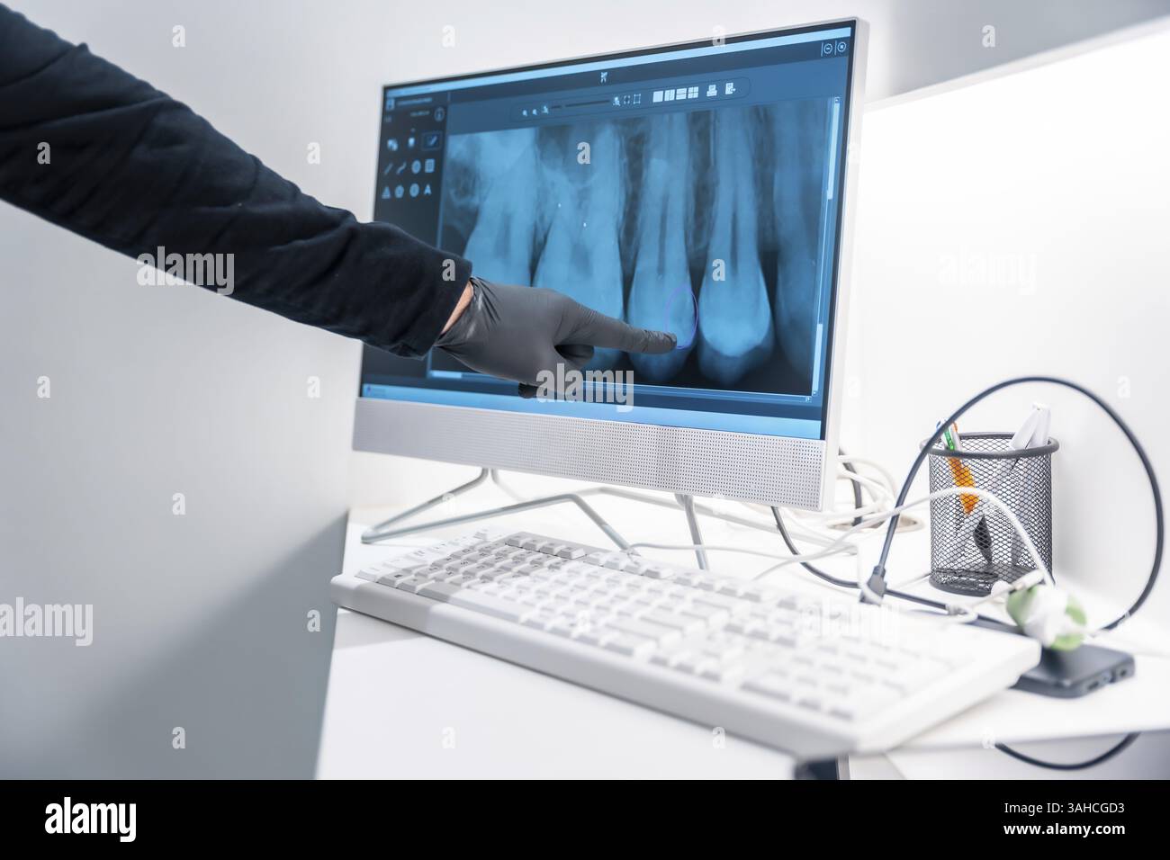 Dentist wearing black gloves pointing at teeth x ray on a computer ...