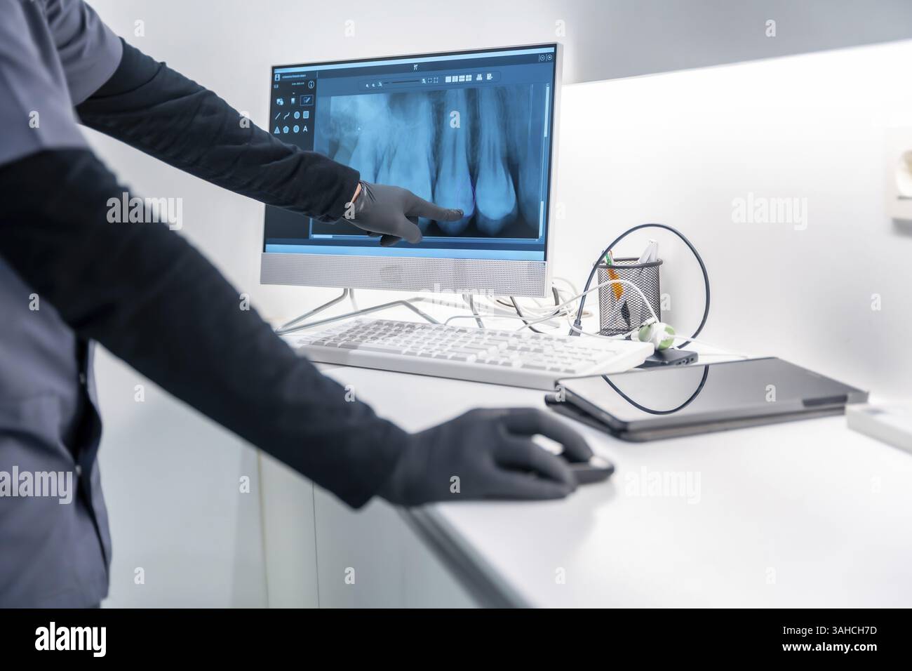Dentist pointing at a dental x ray on a computer screen, showcasing ...