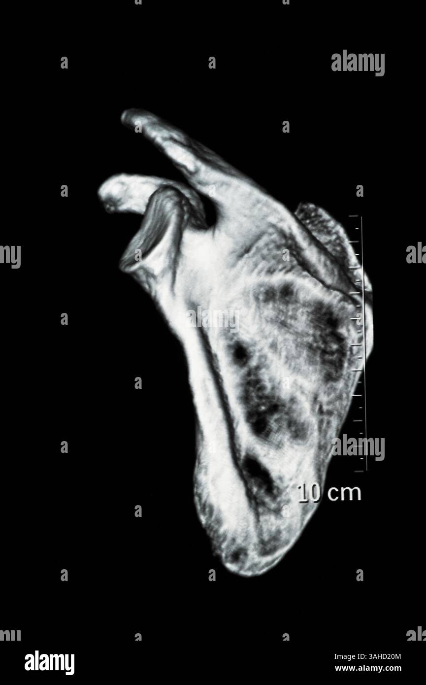 Human bone CT images Stock Photo - Alamy