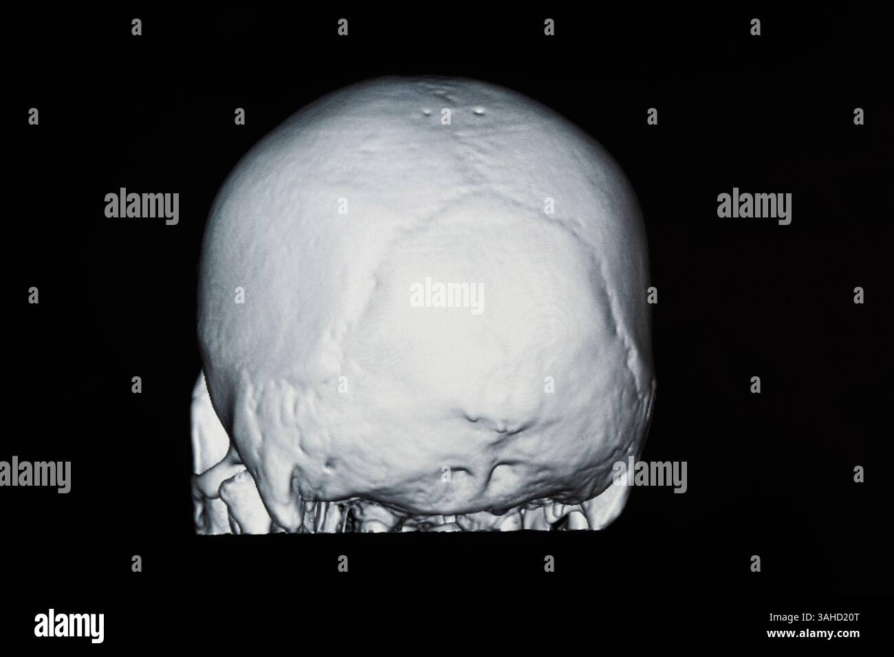 Human skull CT scans Stock Photo - Alamy