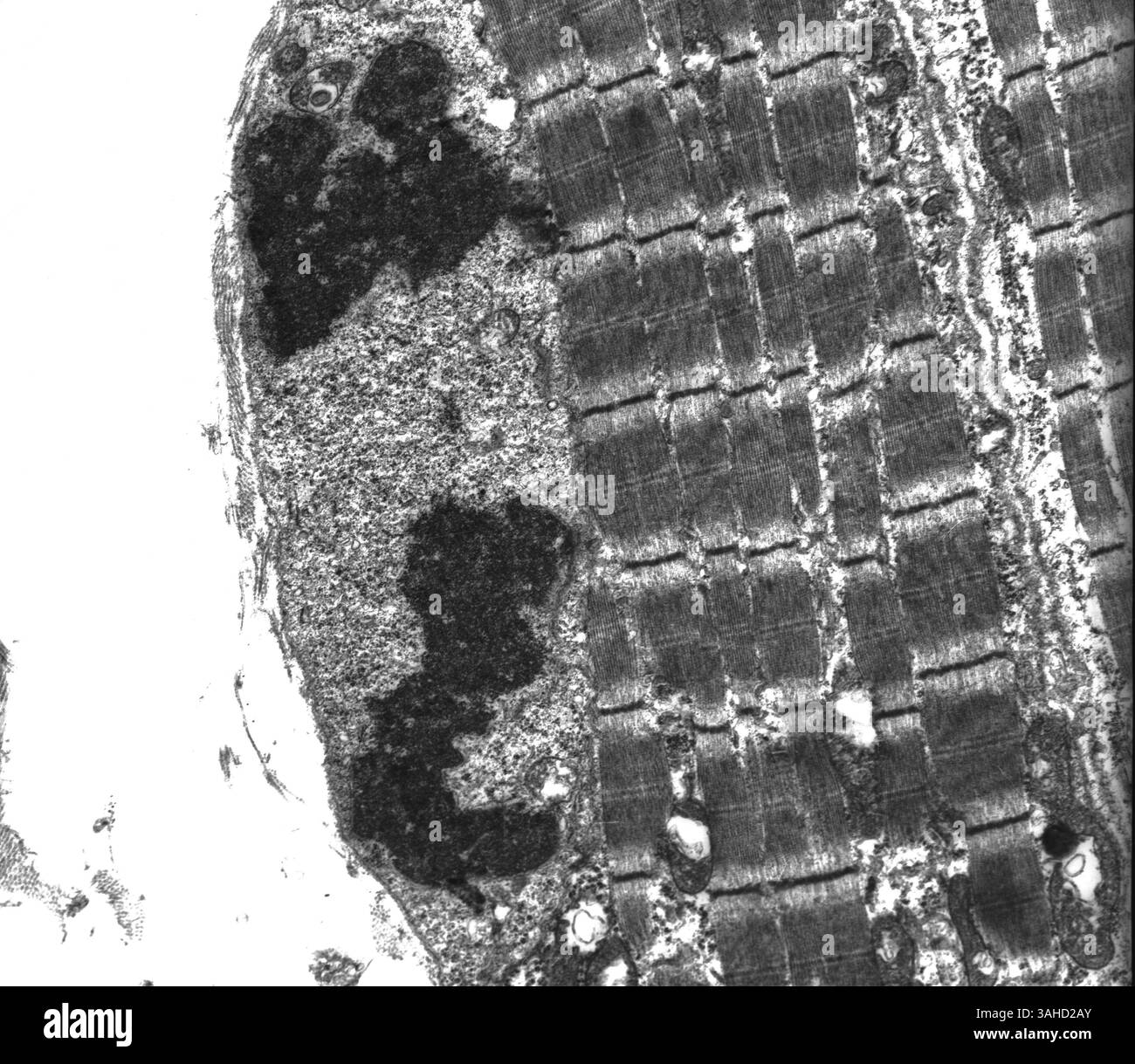 Transmission electron micrograph (TEM) of a satellite cell (centre left ...