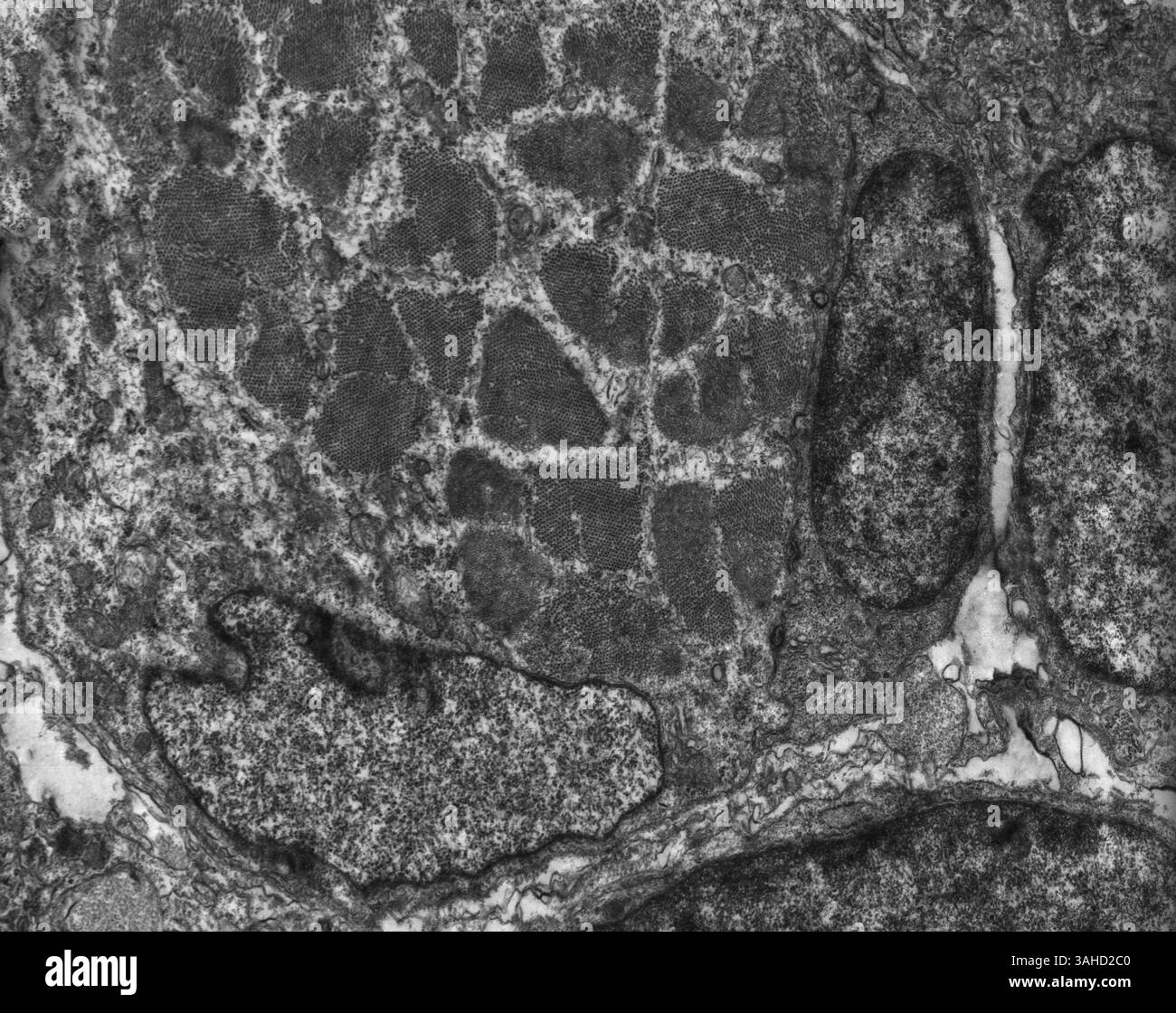 Transmission electron micrograph (TEM) of a cross-section through a striated muscle fiber ...