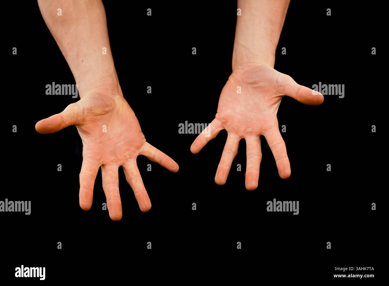 Two open hands with spread fingers on a black background Stock Photo ...