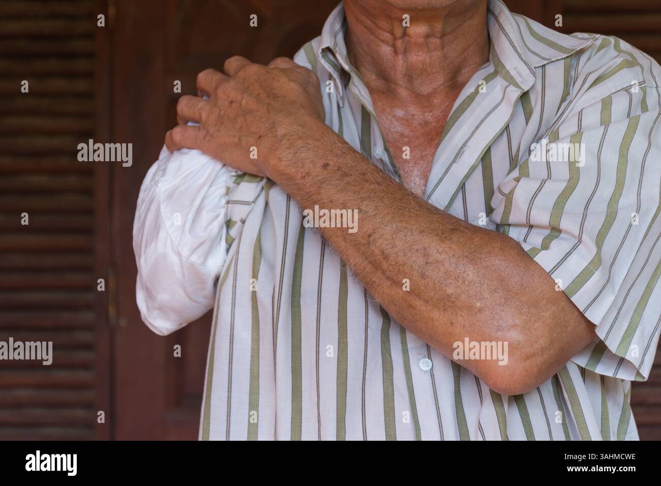 Asia elderly man have tanned skin disabled with one arm and arm ...