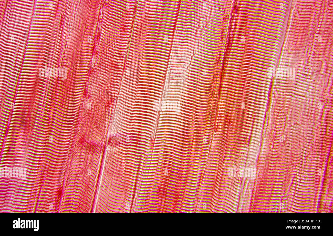 Muscle, Striated Human Muscle Magnified 400x Stock Photo - Alamy