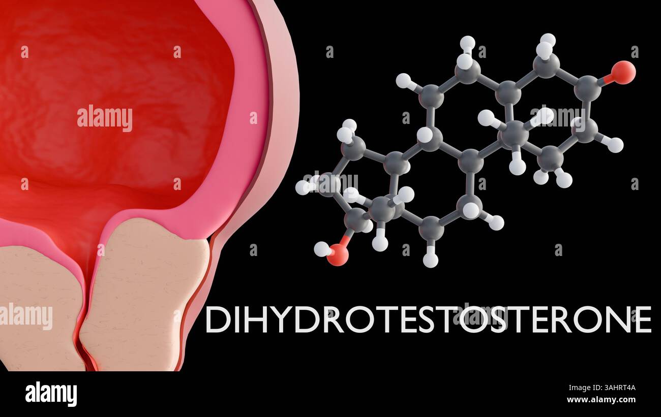 a 3d rendering of cross-section of the prostate gland and the text ...