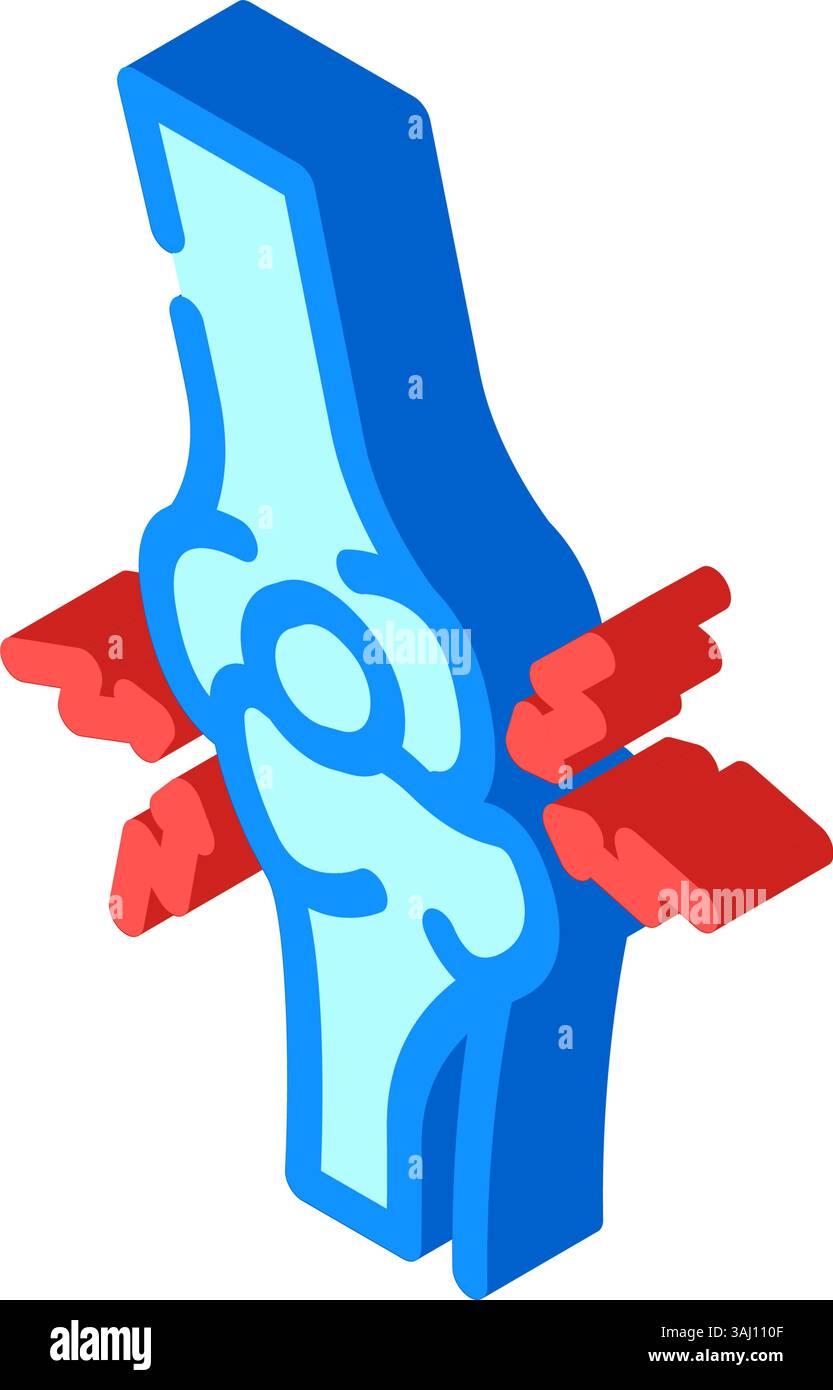 joint dislocation fracture injury isometric icon vector illustration ...