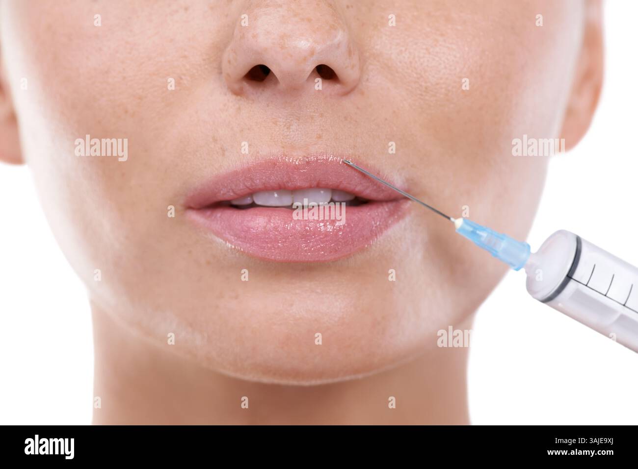 Plastic surgery, lip filler and woman closeup with syringe for beauty, cosmetic process and ...