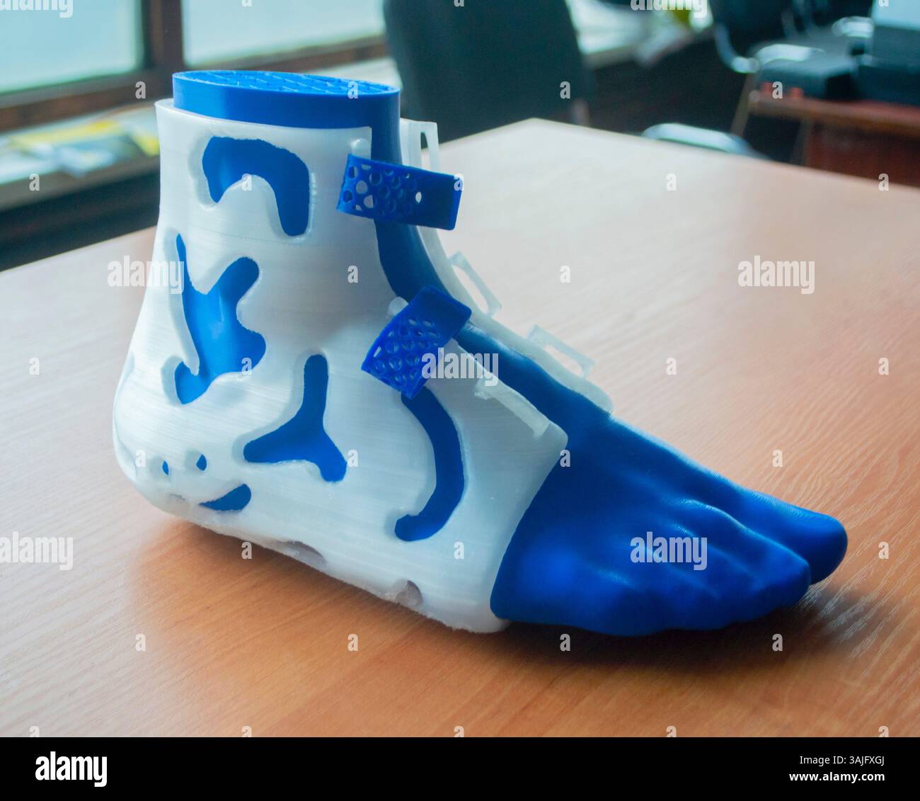 Prosthesis printed on a 3D printer from molten plastic on a plastic ...
