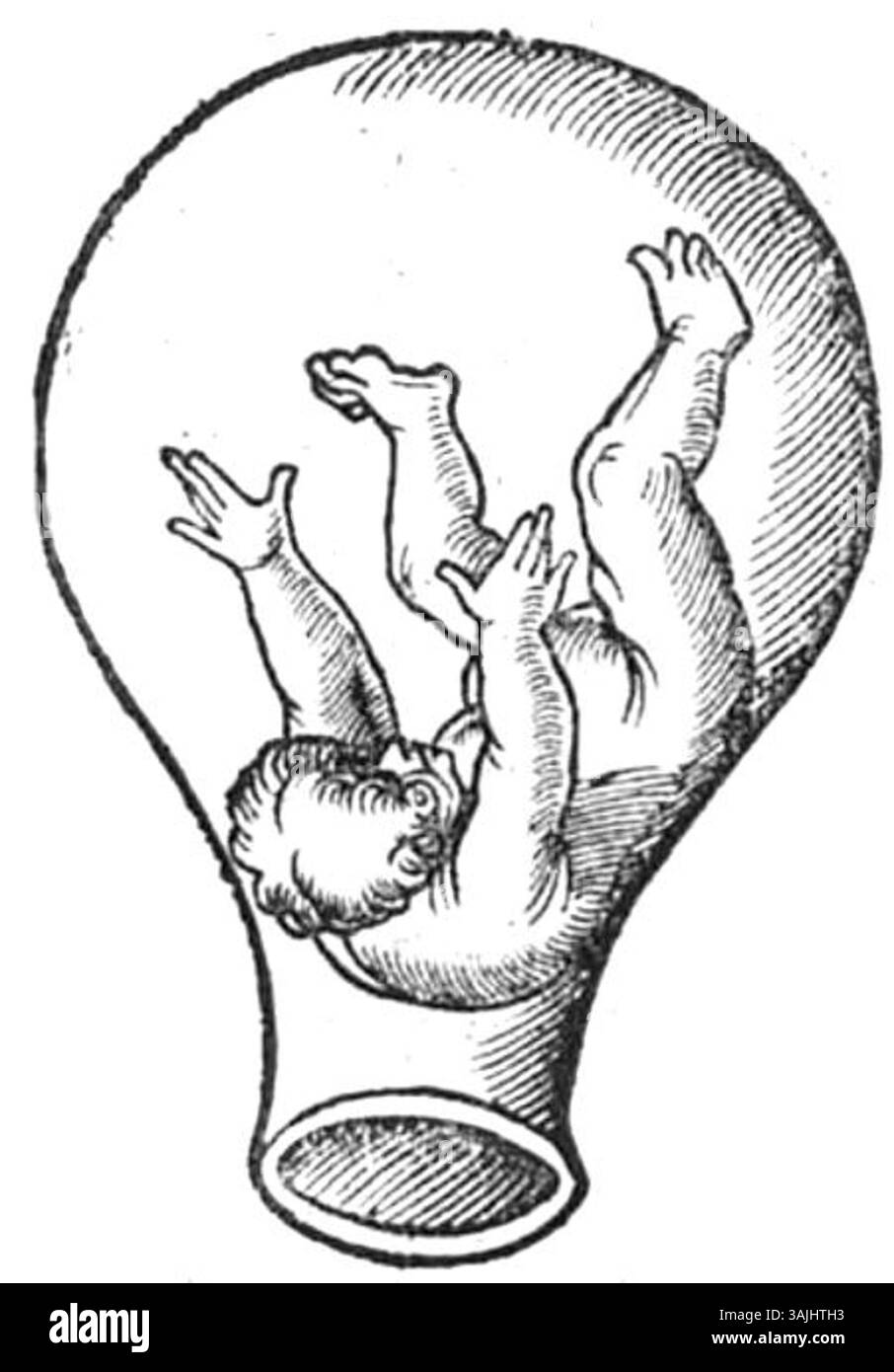 Early modern obstetrics hi-res stock photography and images - Alamy