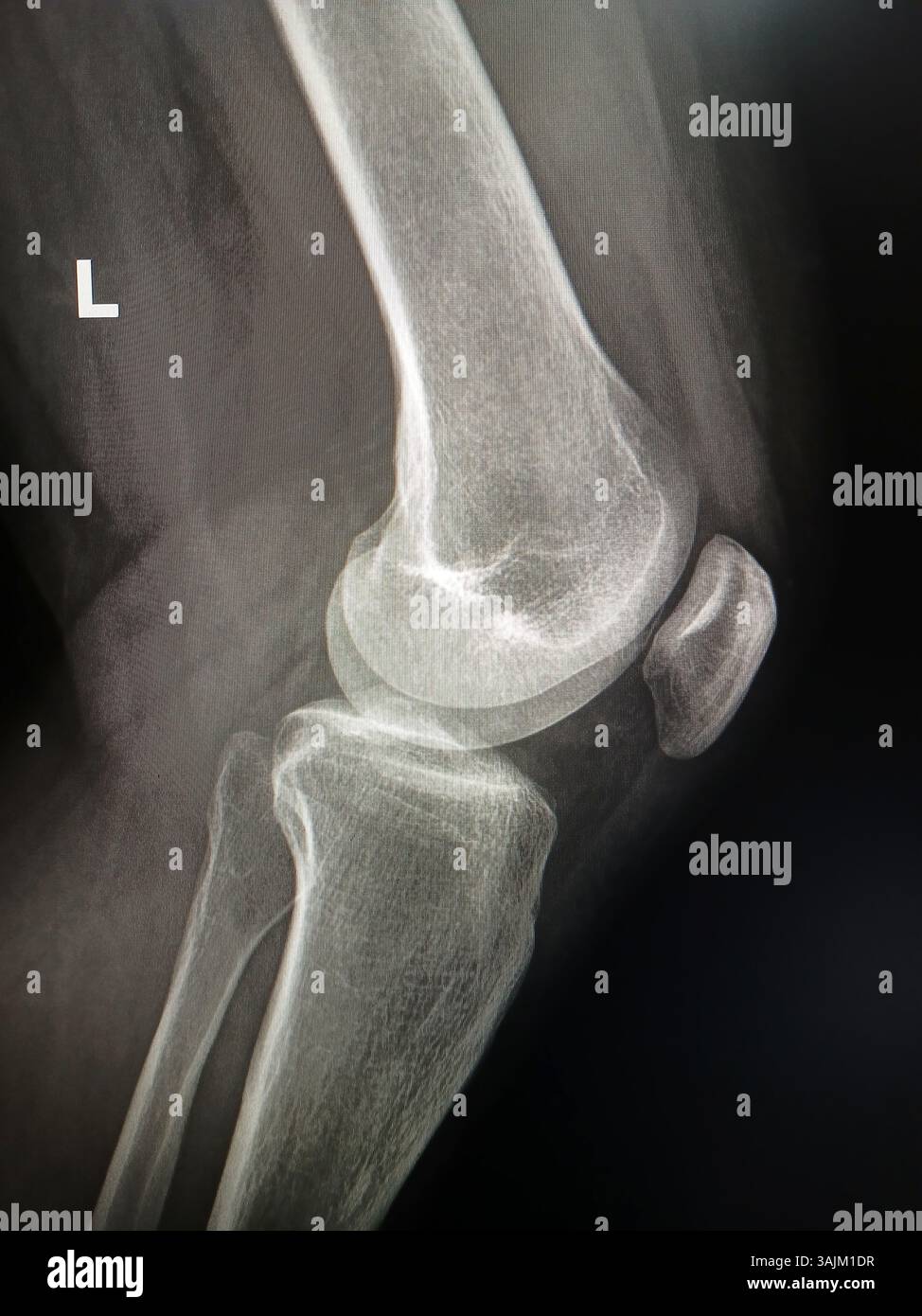 Knee joint structure hi-res stock photography and images - Alamy